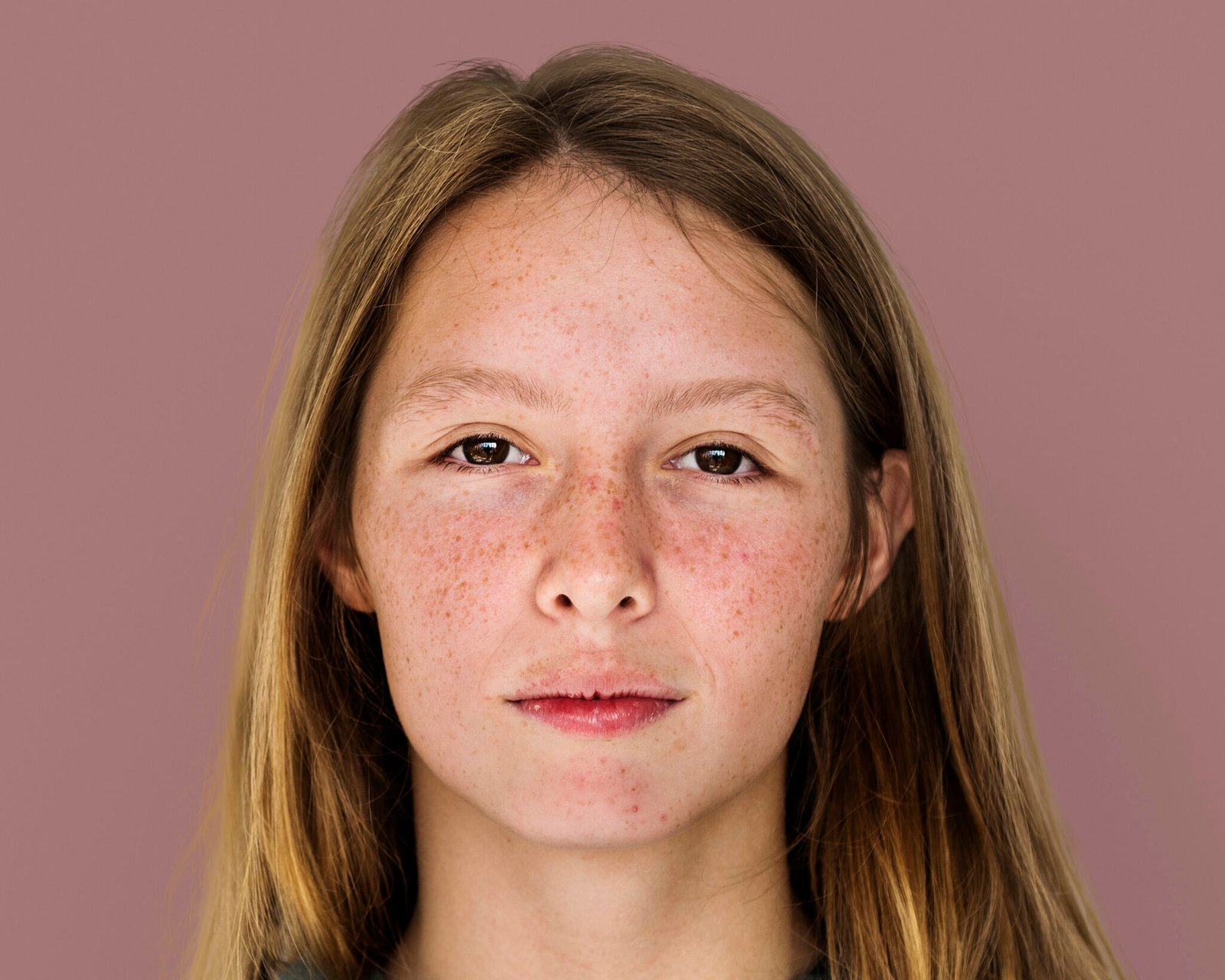 Clogged Pores on Face: Causes, Symptoms, and How to Clear